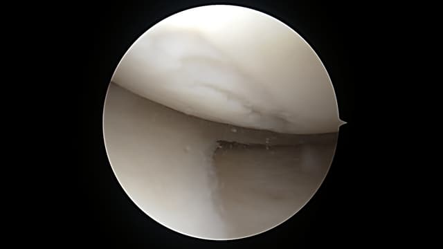 London Cartilage Clinic | Cartilage specialists offering life-changing ...