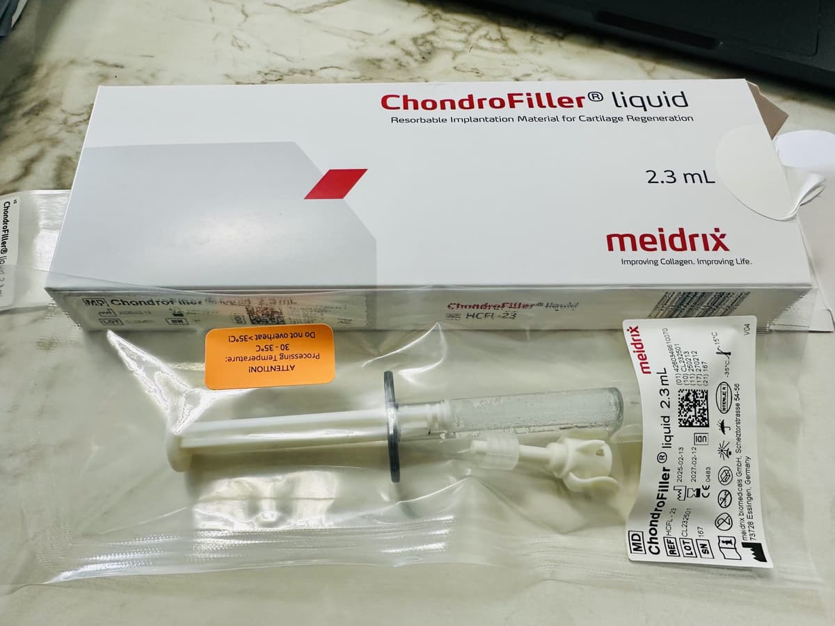 ChondroFiller® Cartilage Regeneration Injection in London | Harley ...