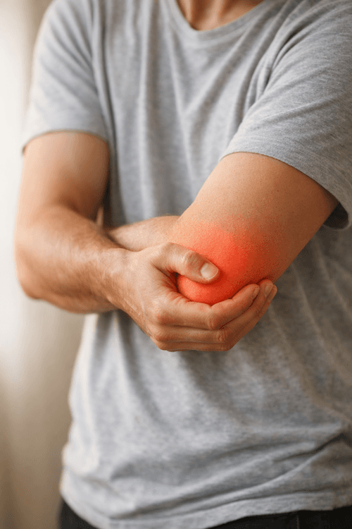 Golfer's Elbow (Medial Epicondylitis) | London Cartilage Clinic ...