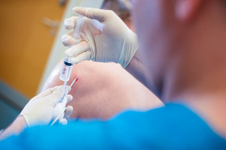 Stem Cell / Medicinal Signaling Cell Shoulder Therapy | London ...